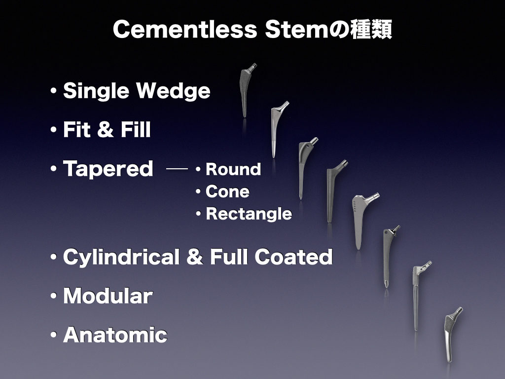 ステムの基礎知識8 （Cementless Stemの種類3） │ 整形外科のいろいろ