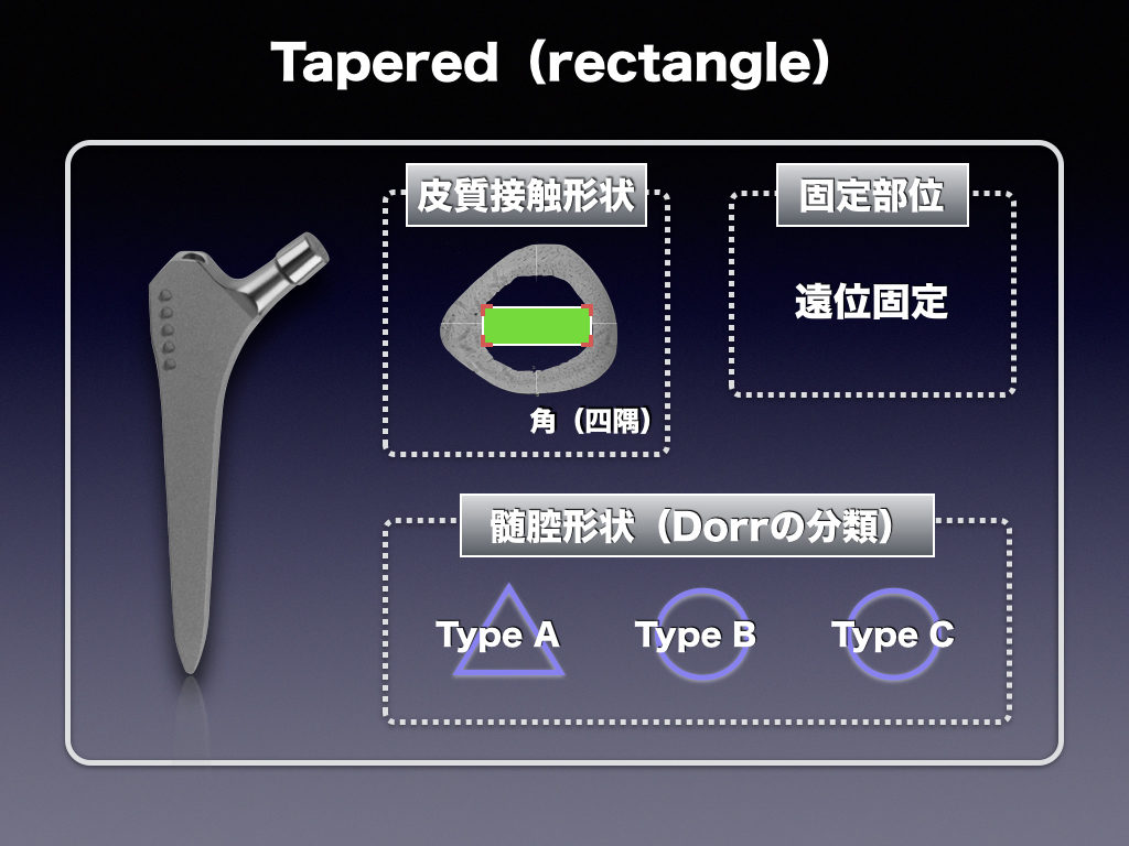 ステムの基礎知識7 （Cementless Stemの種類2） │ 整形外科のいろいろ
