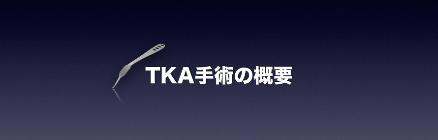 TKA手術の概要 │ 整形外科のいろいろ